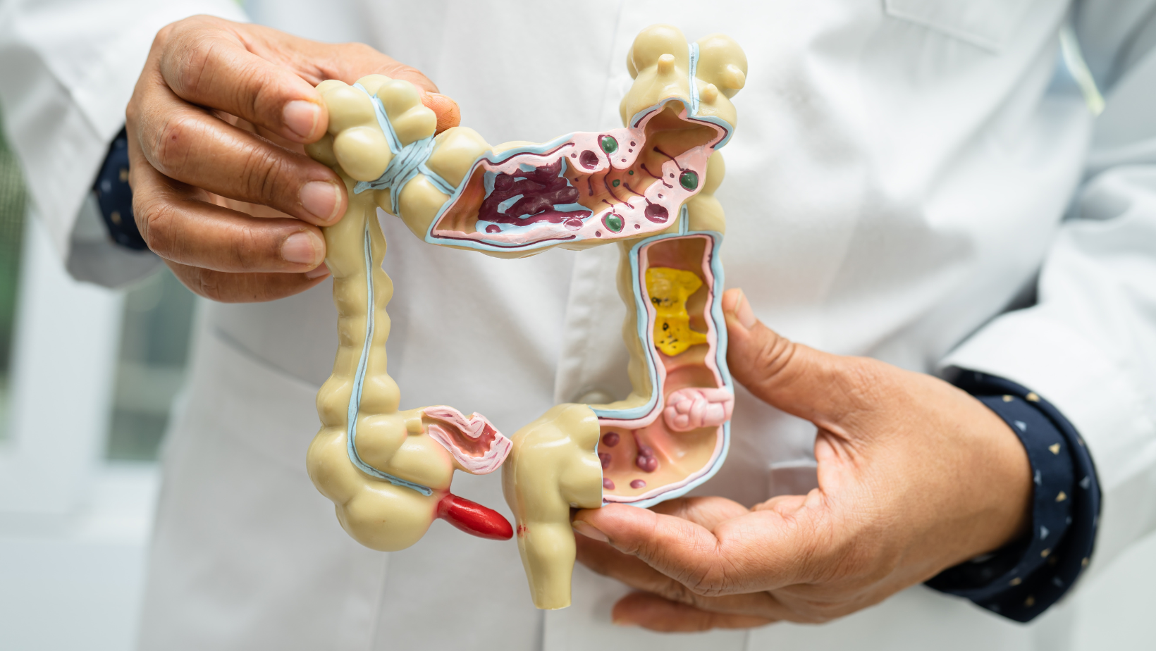 The Importance of Gut Health: Why Gut Health = Total Body Health ...